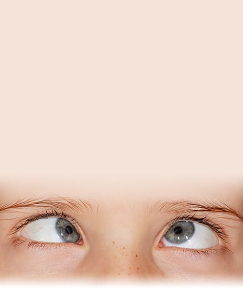 Reason for Squint Eyes in Indian Children | Diagnosis & Treatment | MFine