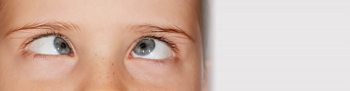 Reason for Squint Eyes in Indian Patients | Diagnosis & Treatment