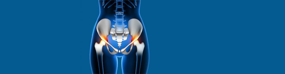 Right Groin Pain in Indians: Causes & How to Prevent It | MFine