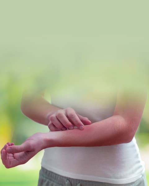 Tinea Cruris Causes and Treatment Options in India | MFine