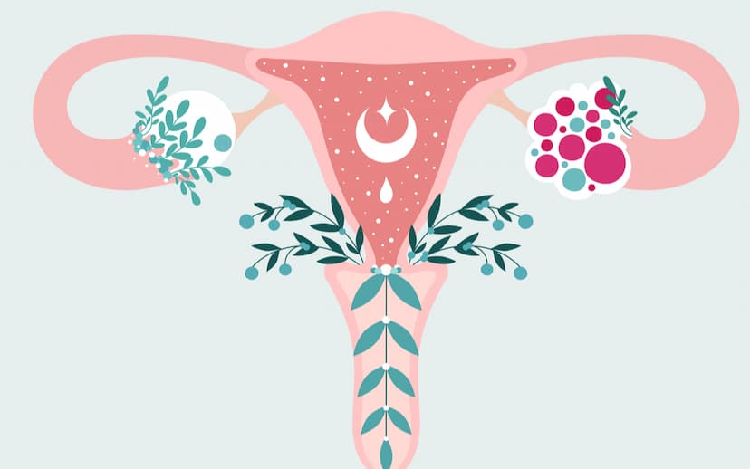 Menstrual Cycle In PCOS | What Are PCOS Periods Like? - MFine